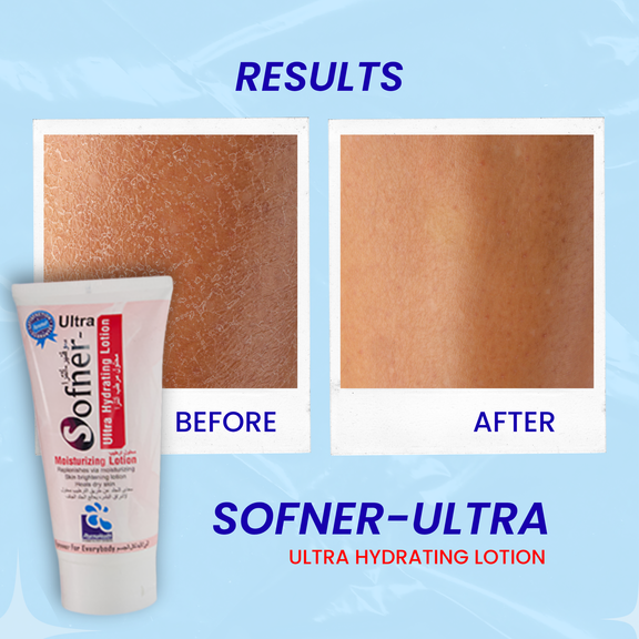 Sofner Ultra Hydrating Lotion ( Keep the skin moisturized & soft ...