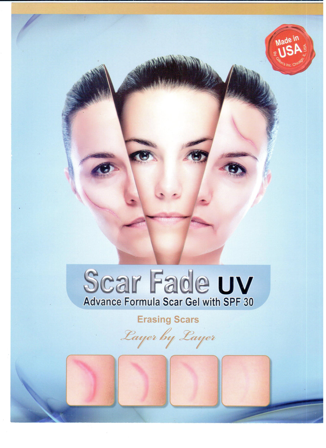 Scar Fade UV ( Reduces scar-associated pain, itching, and discoloratio ...